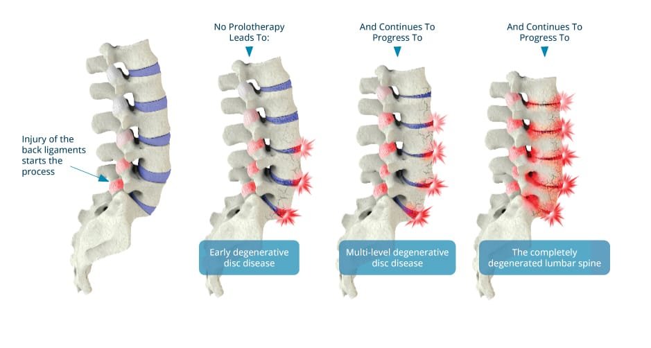Science behind Regenerative Medicine - Integrated Spine, Pain & Wellness